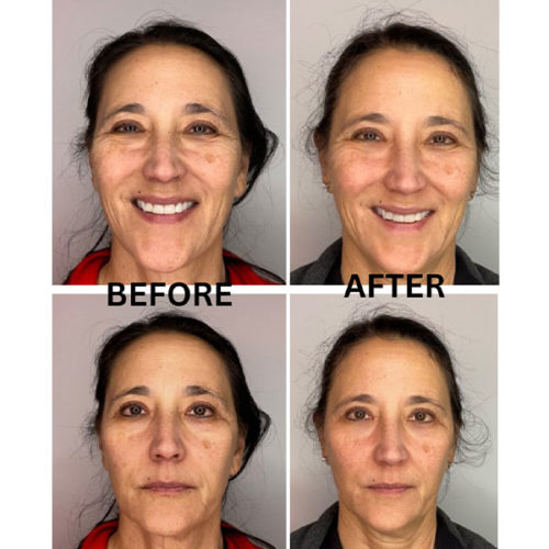 Gallery San Carlos, CA | Premier Dermatology